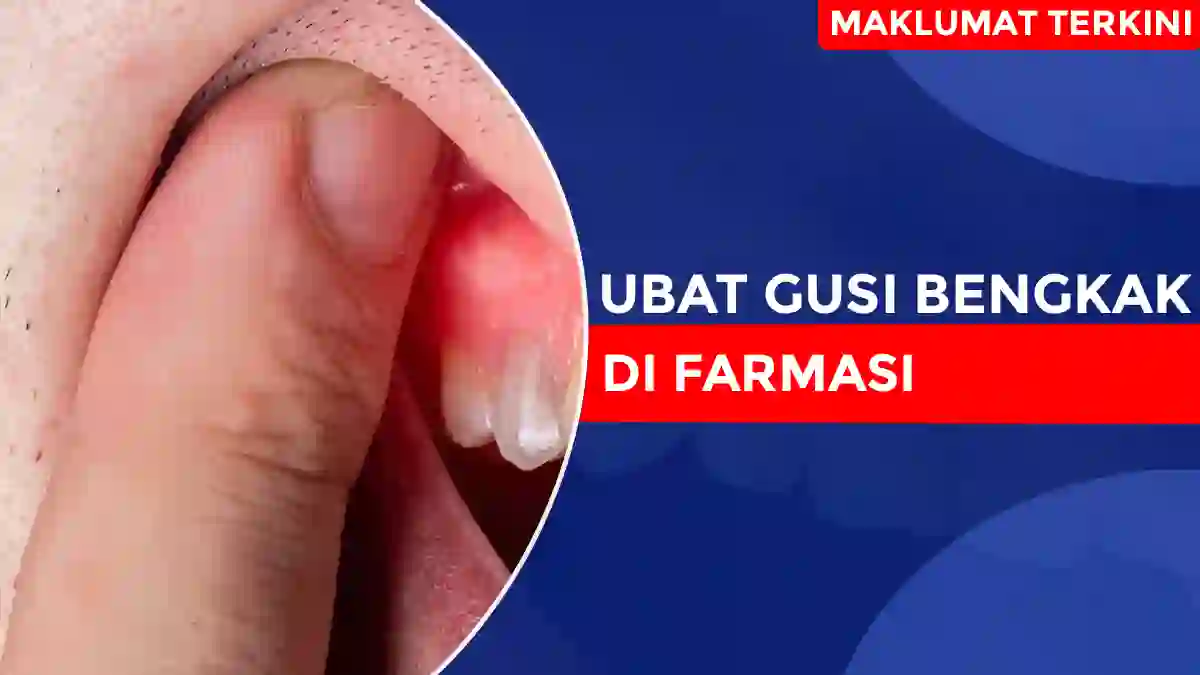 17 Ubat Gusi Bengkak di Farmasi Terbaik 2026 - Infoubat.com