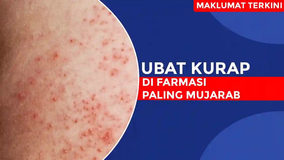 15 Ubat Kurap di Farmasi Paling Mujarab 2026 - Infoubat.com