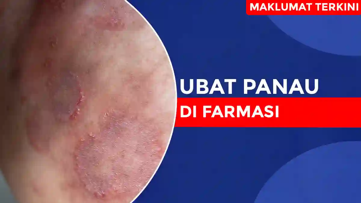 10 Ubat Panau di Farmasi: Terbaik & Berkesan 2025