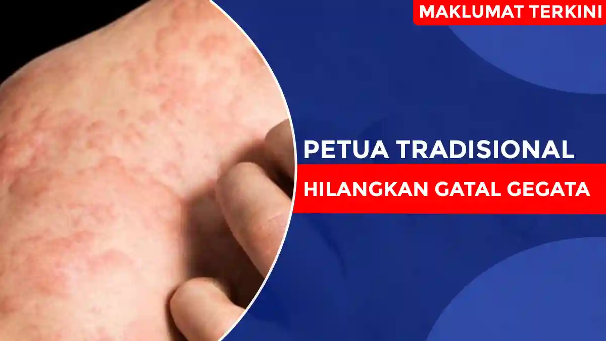 12 Petua Tradisional Hilangkan Gatal Gegata & Punca