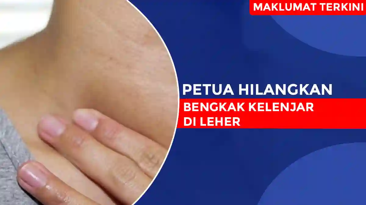 10 Petua Hilangkan Bengkak Kelenjar Di Leher - Infoubat.com