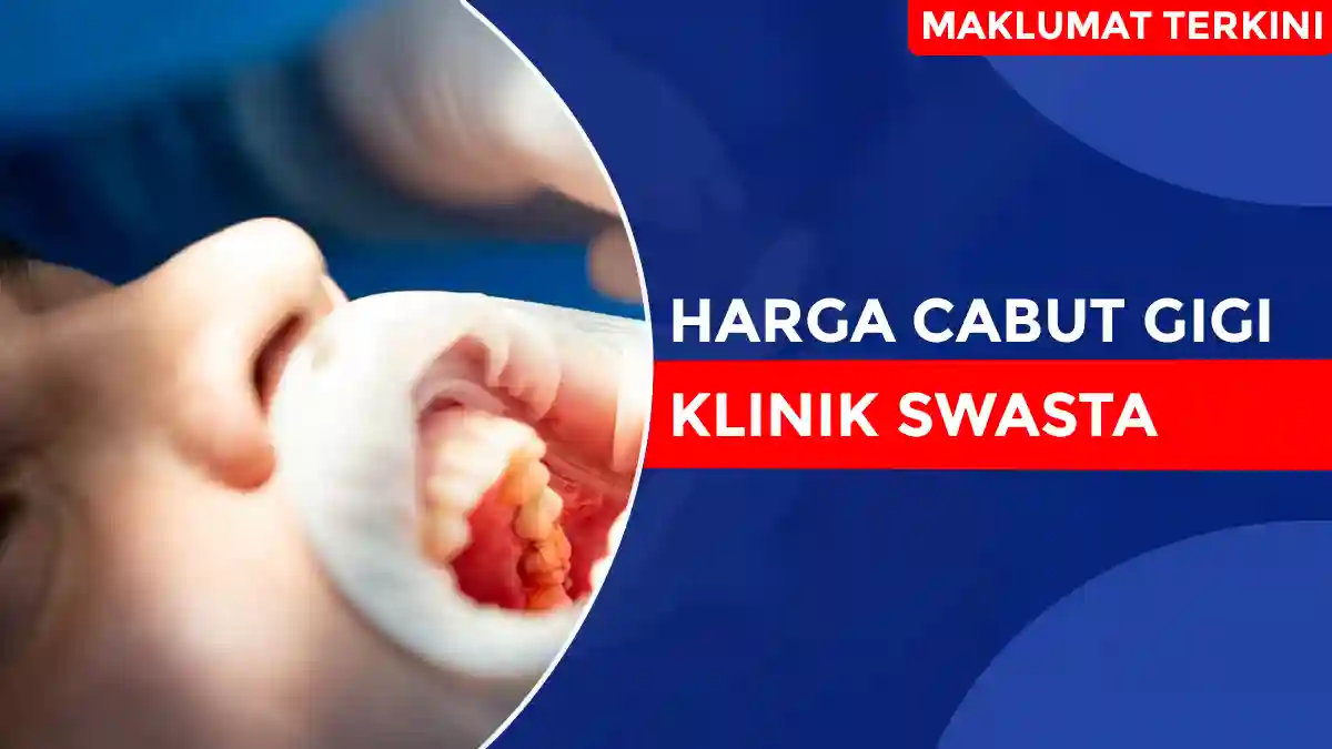 Harga Cabut Gigi Klinik Swasta Terkini 2026